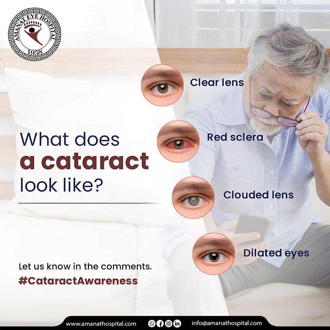 Amanat Eye Hospital Offering the latest Cataract laser Surgery in ...