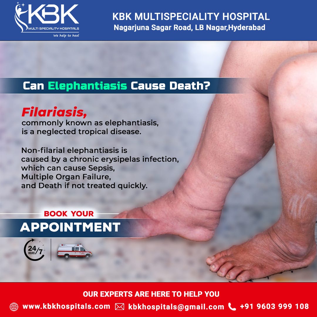 𝑪𝒂𝒏 𝑬𝒍𝒆𝒑𝒉𝒂𝒏𝒕𝒊𝒂𝒔𝒊𝒔 𝑪𝒂𝒖𝒔𝒆 𝑫𝒆𝒂𝒕𝒉? - KBK Hospitals - Medium