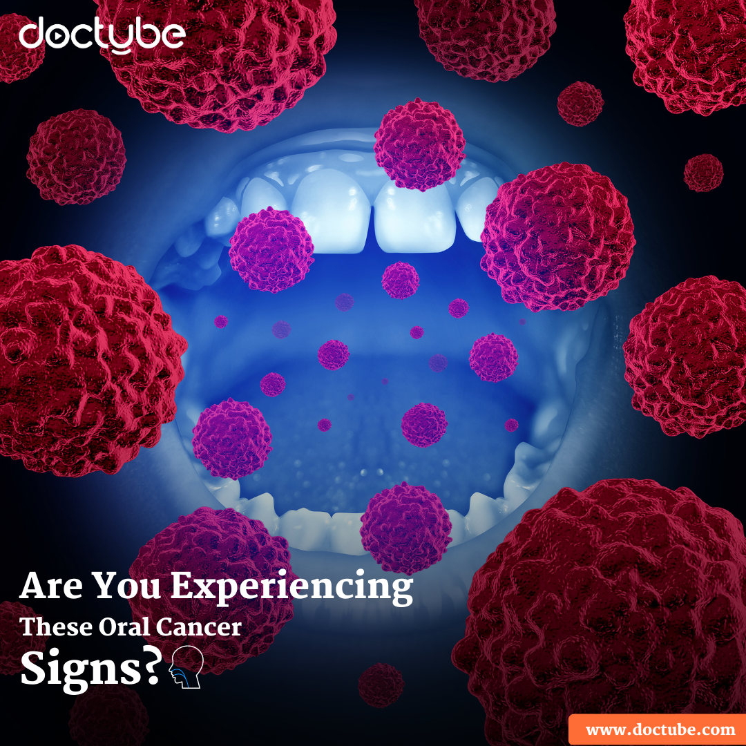 Are You Experiencing These Oral Cancer Signs? - DocTube - Medium