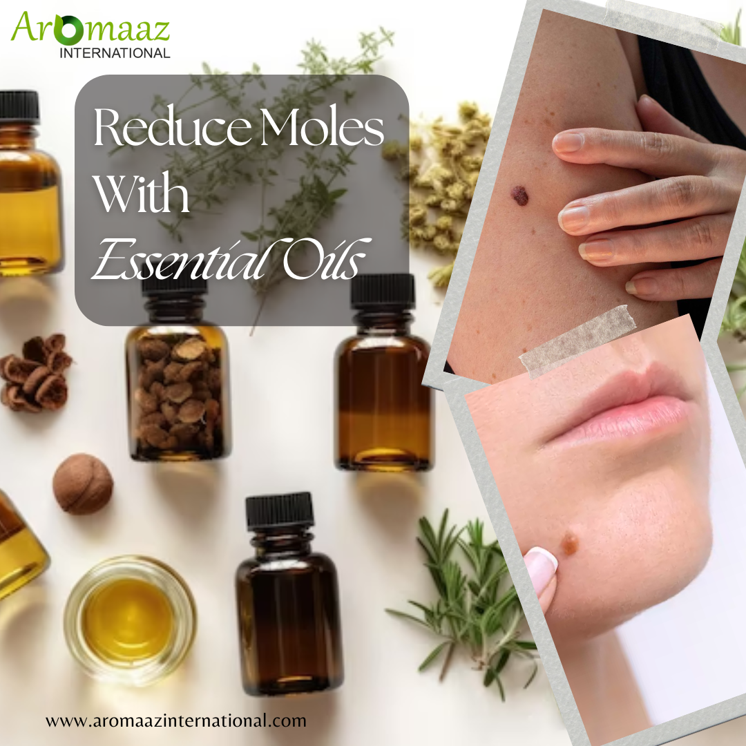 Essential Oils for Mole-Free Skin - Aromaaz International - Medium