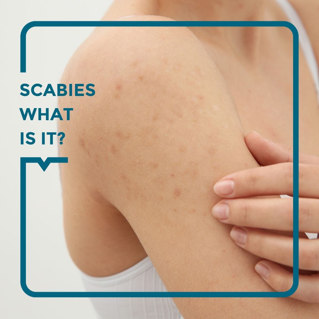 What Is Scabies Causes Symptoms Diagnosis Treatment And Preventions Faqs In 2023 By