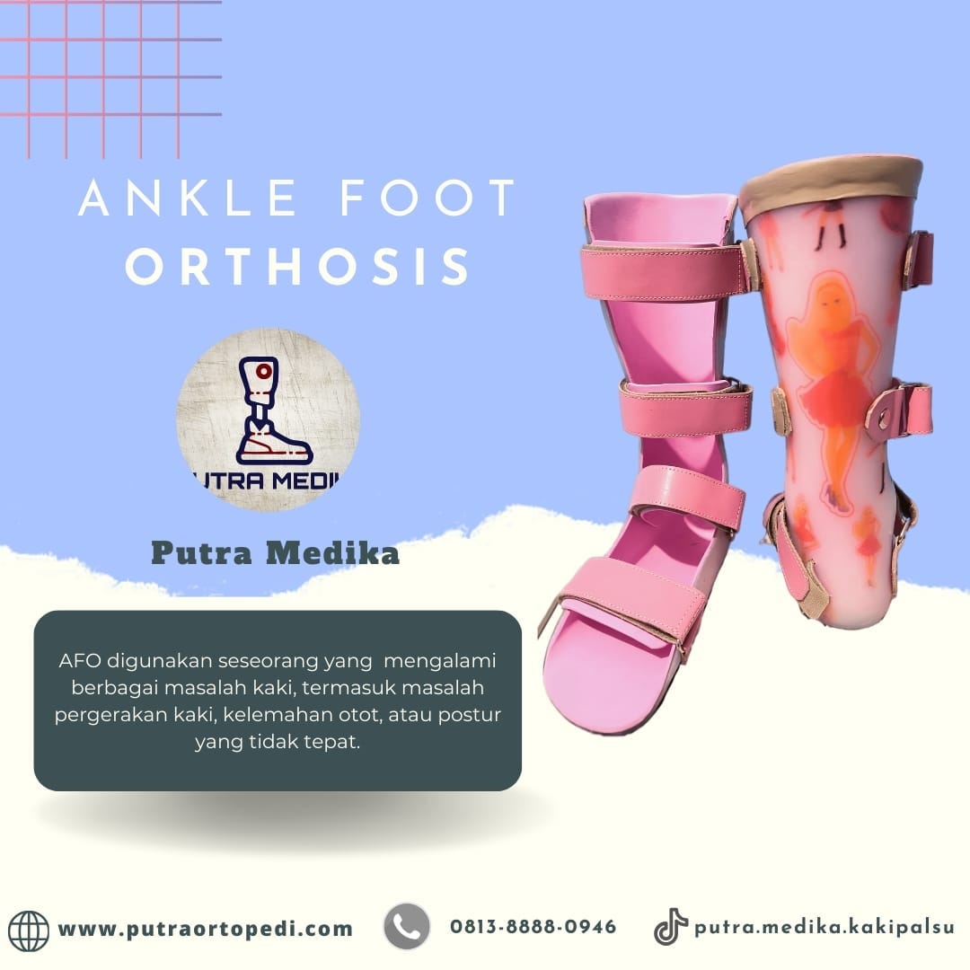 Sepatu AFO Wa kami 0813-8888-0946 | by WA 0813-8888-0946 Pembuatan Kaki ...