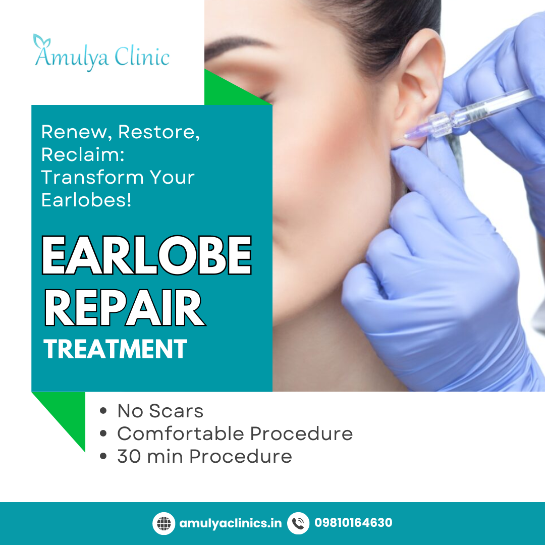 Earlobe Repair Treatment: Restore Your Confidence | Best Cosmetic ...