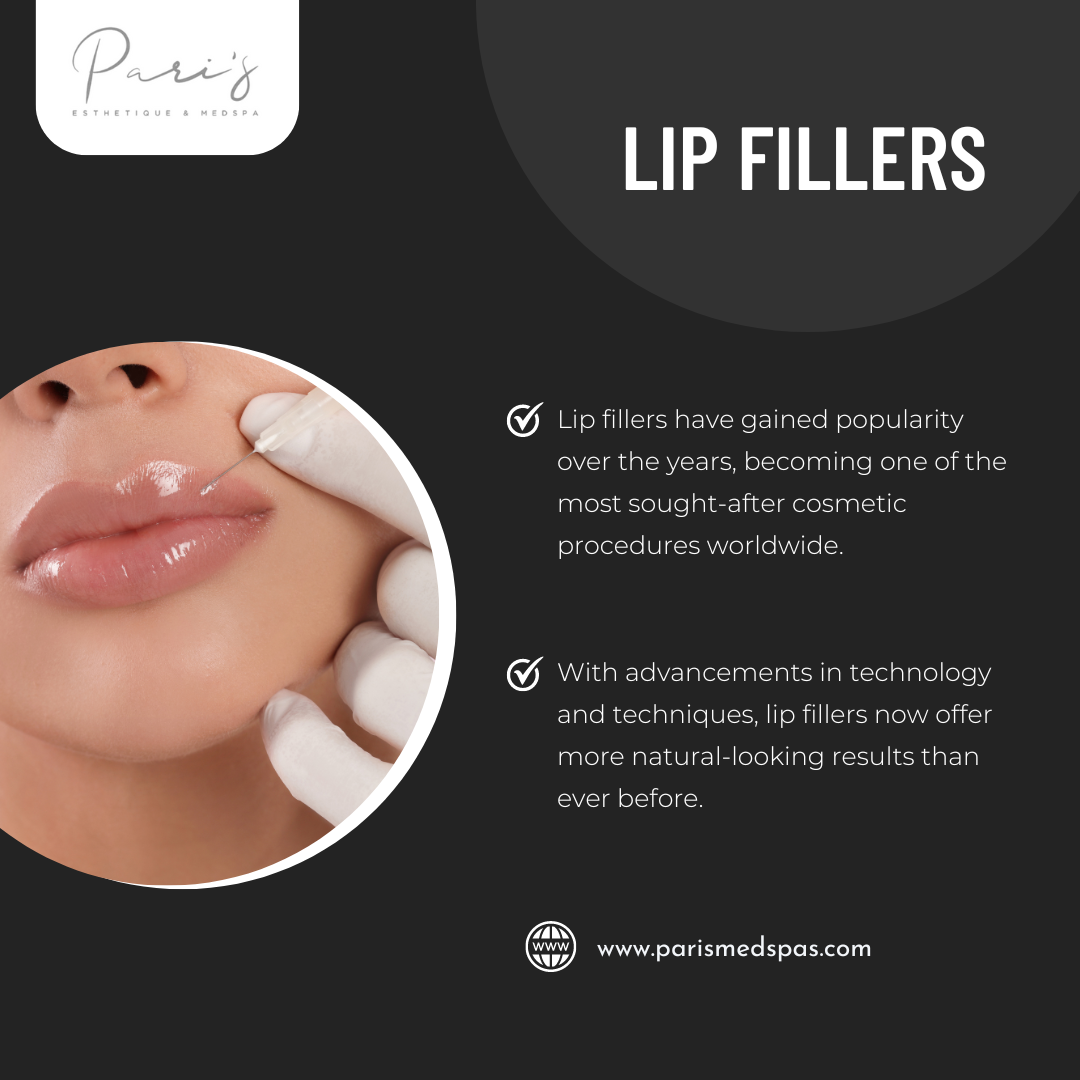 Affordable and Effective Lip Fillers in Prosper and Little Elm, TX | by ...