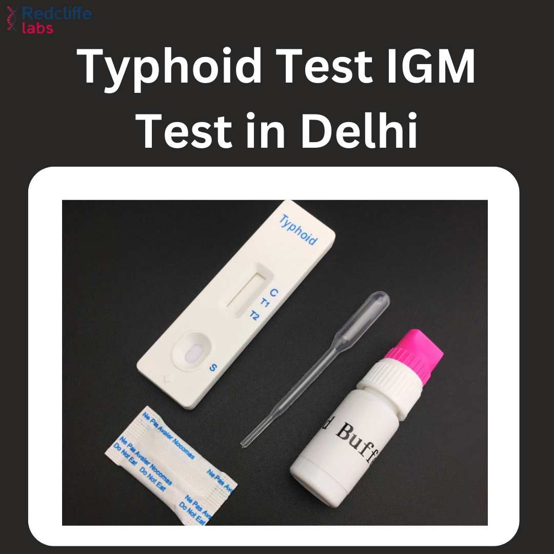 Typhoid IgM Fever Test at Best Price in Delhi, Book Now - red cliffe ...