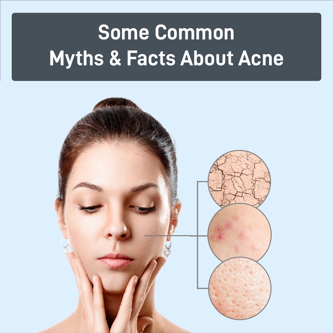 What are the 4 types of acne? and treatments | by Ayanshi | Medium