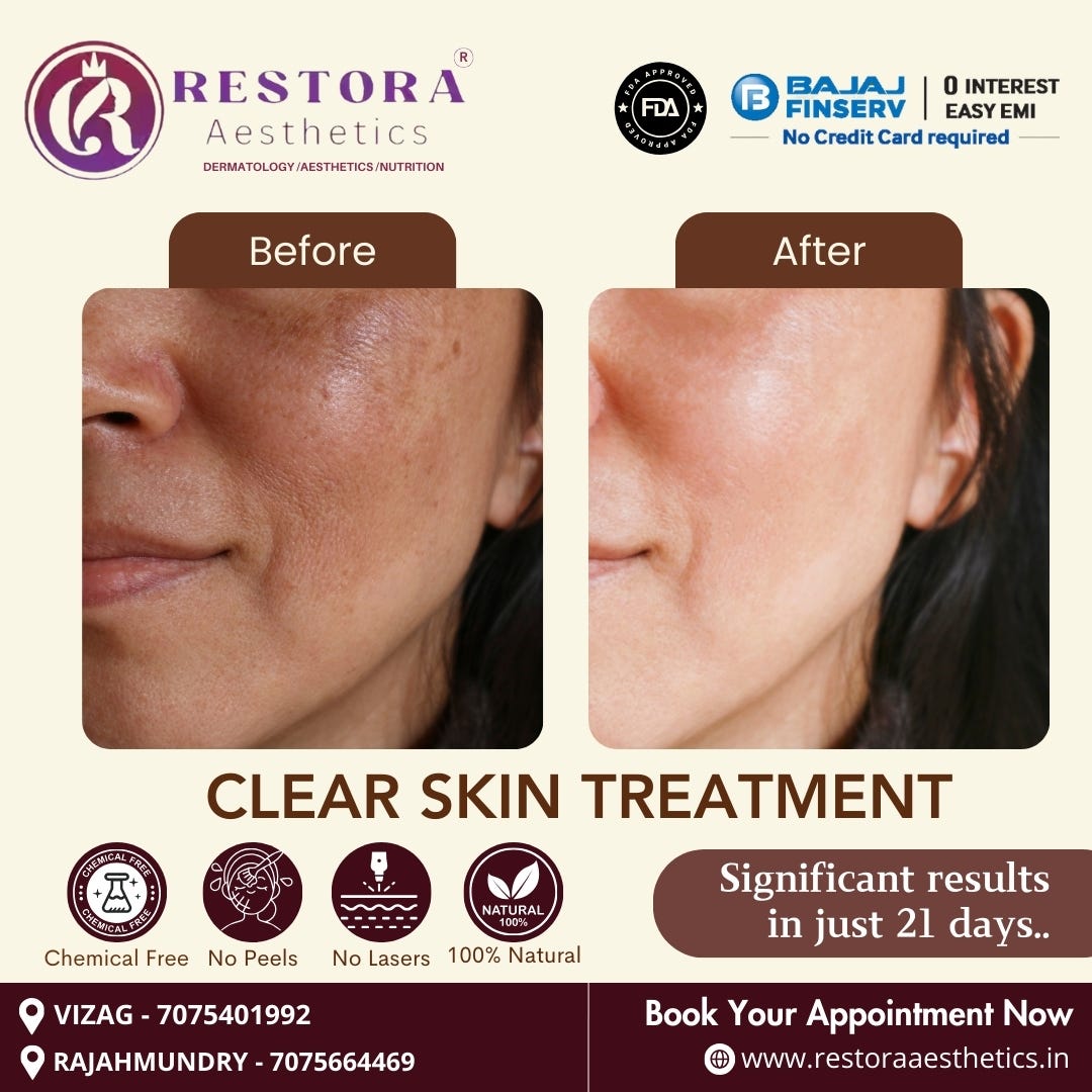 Clear Skin Treatment in Vizag & Rajahmundry - Restora Aesthetics - Medium