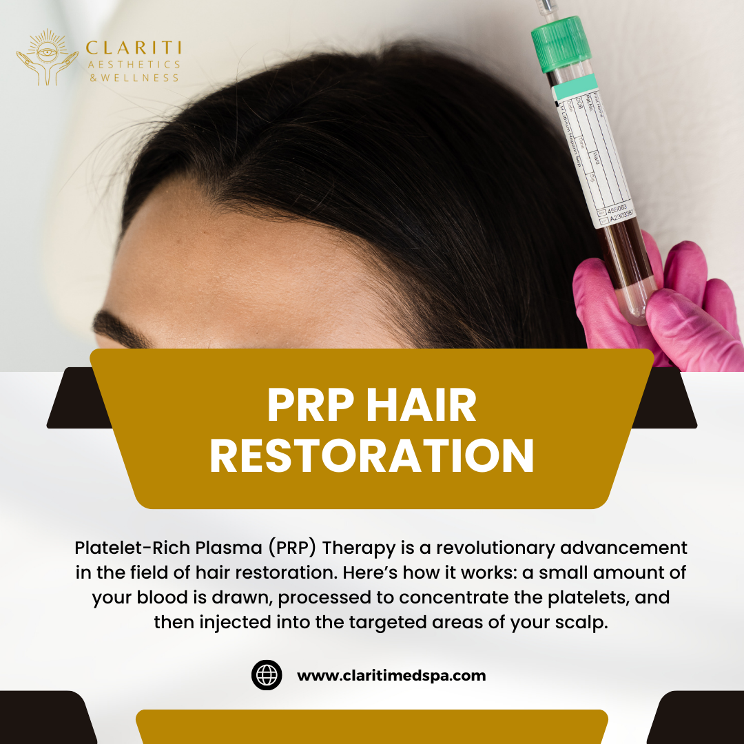 Memorial Houston, TX: Embrace Confidence with PRP Hair Restoration | by ...