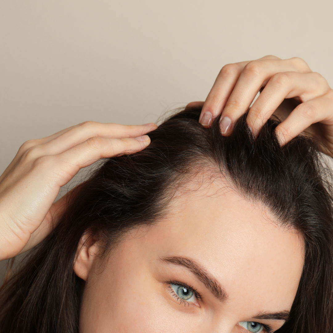 5 Ways to Manage Excess Sebum On Scalp | by Gilfa Joy Salibio | Medium