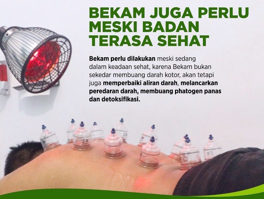 Bekam (hijama) adalah - Bekam Kudus - Medium