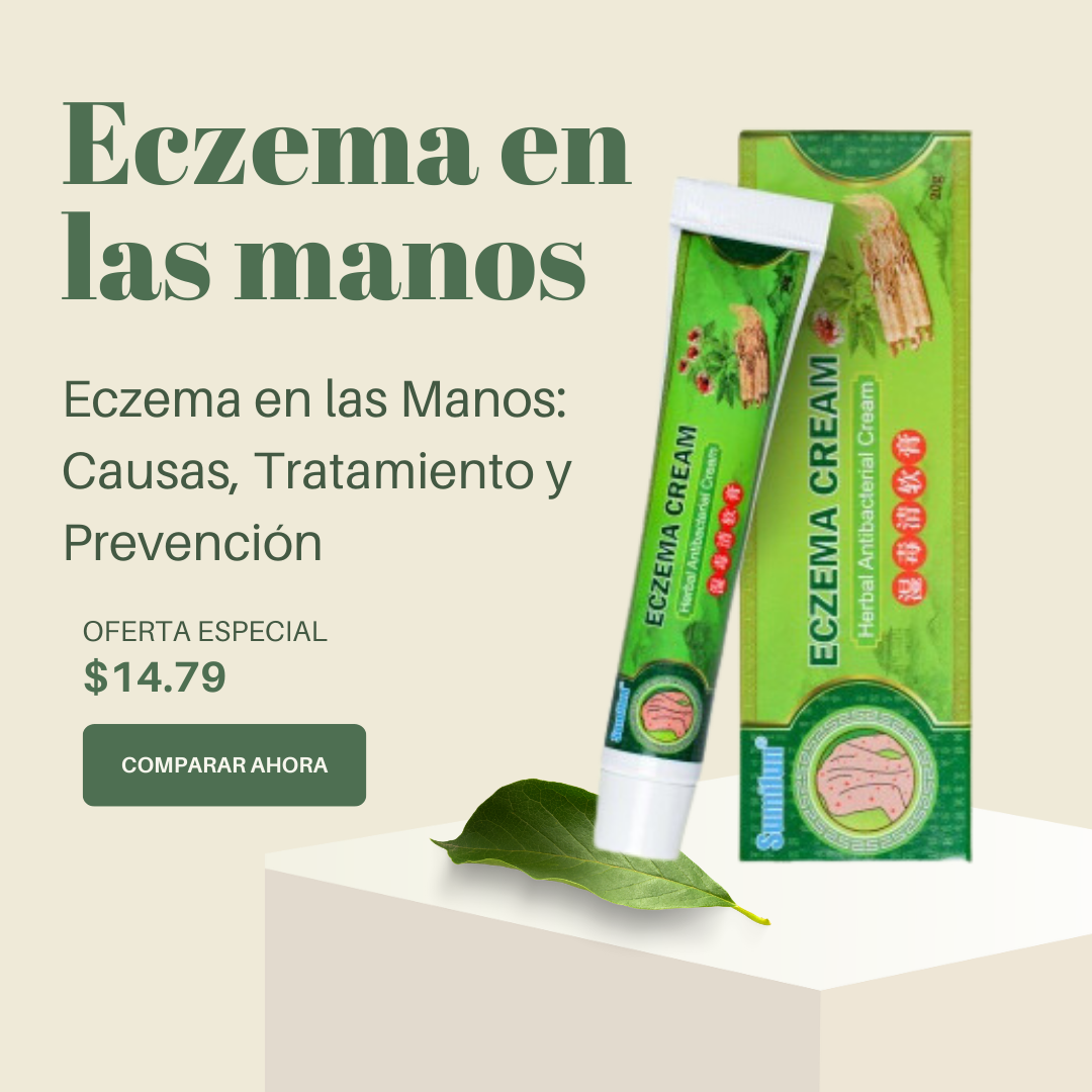 Eczema en las Manos: Causas, Tratamiento y Prevención | Medium