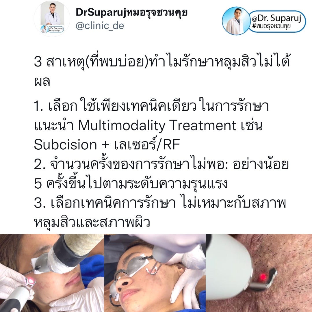 📍3 สาเหตุที่พบบ่อย ทำไมรักษาหลุมสิวไม่ได้ผล - Dr. Suparuj หมอรุจชวนคุย Acne Scar Treatment - Medium