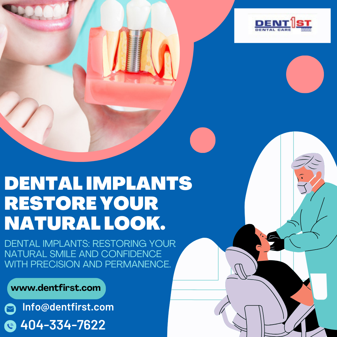 Avoiding Complications: Precautions After Implant Surgery | by Jack ...