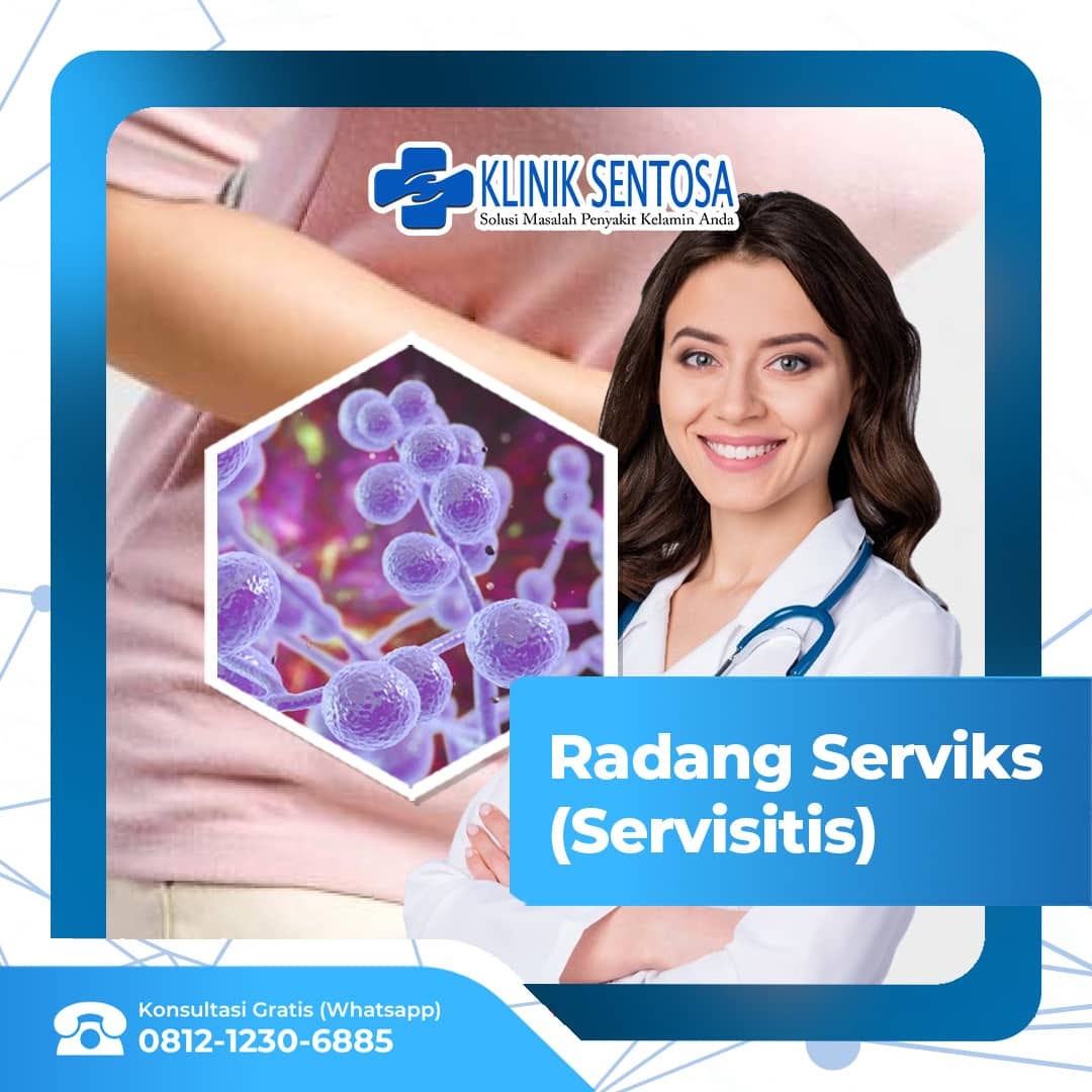 Ketahui Gejala Radang Serviks (Servisitis) yang Sering Diabaikan | by ...