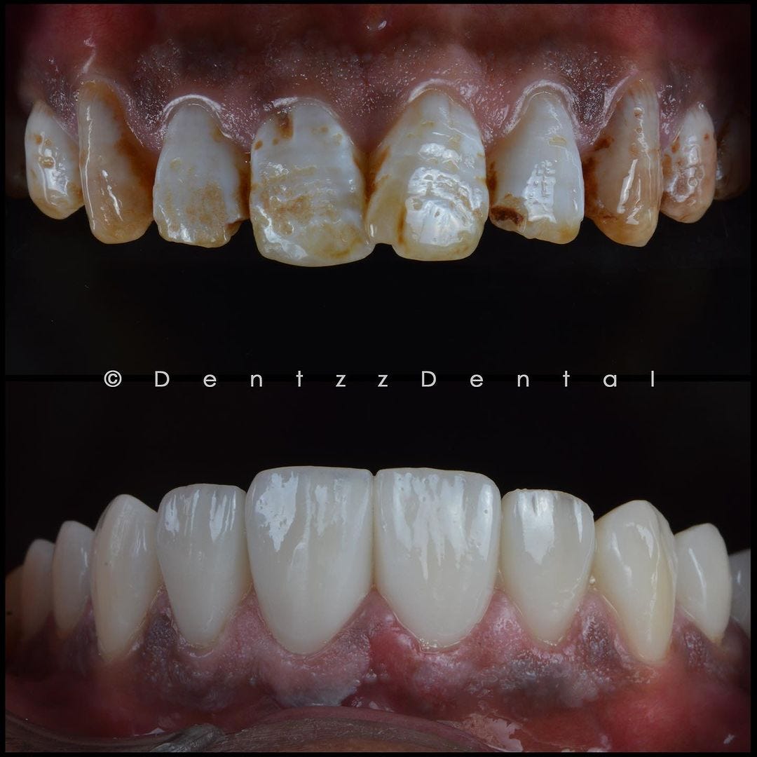 Dentzz Review - Dentzz Dental - Medium