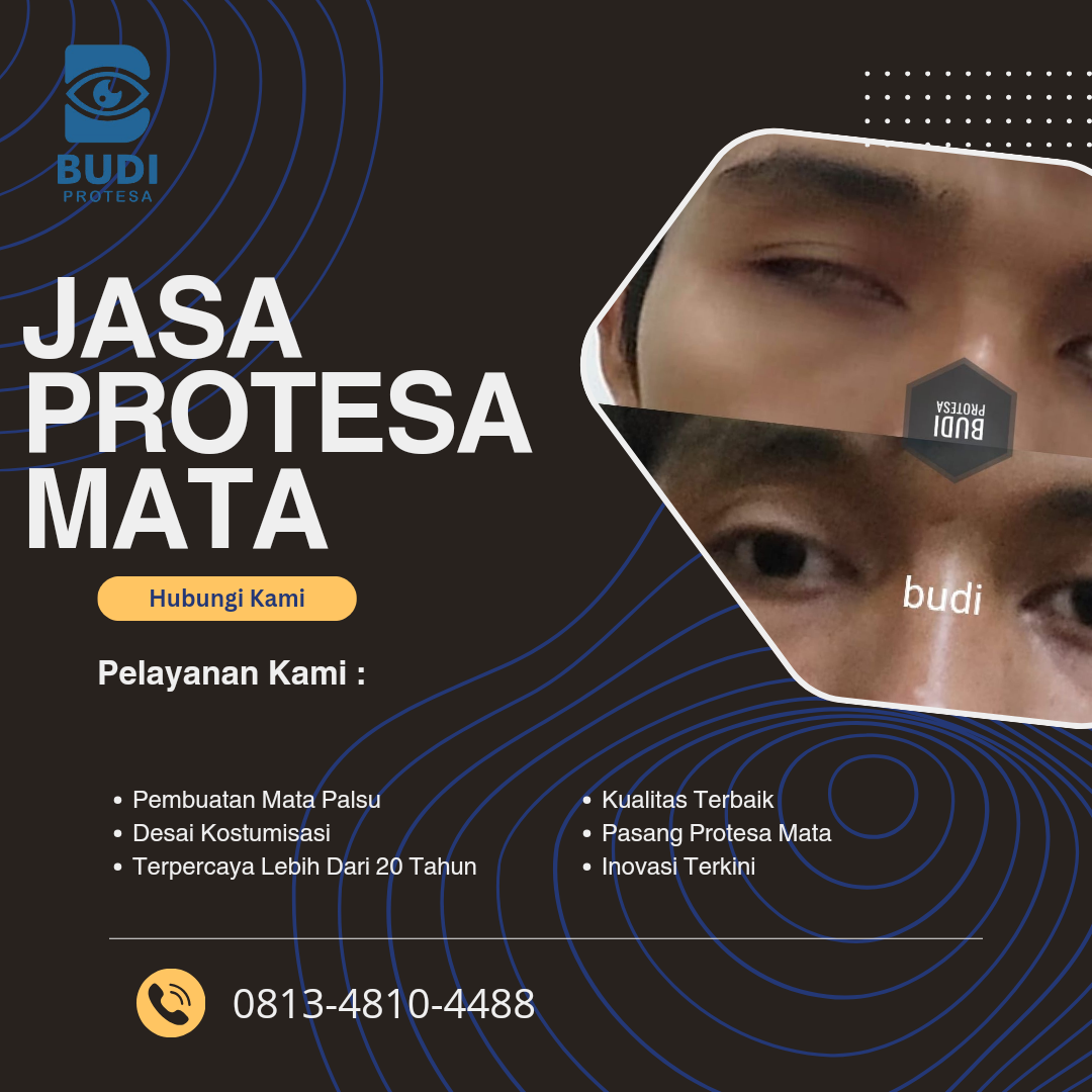 TERPERCAYA!! 0813–4810–4488 (BUDI PROTESA), Pembuat Protesa Mata Palsu ...