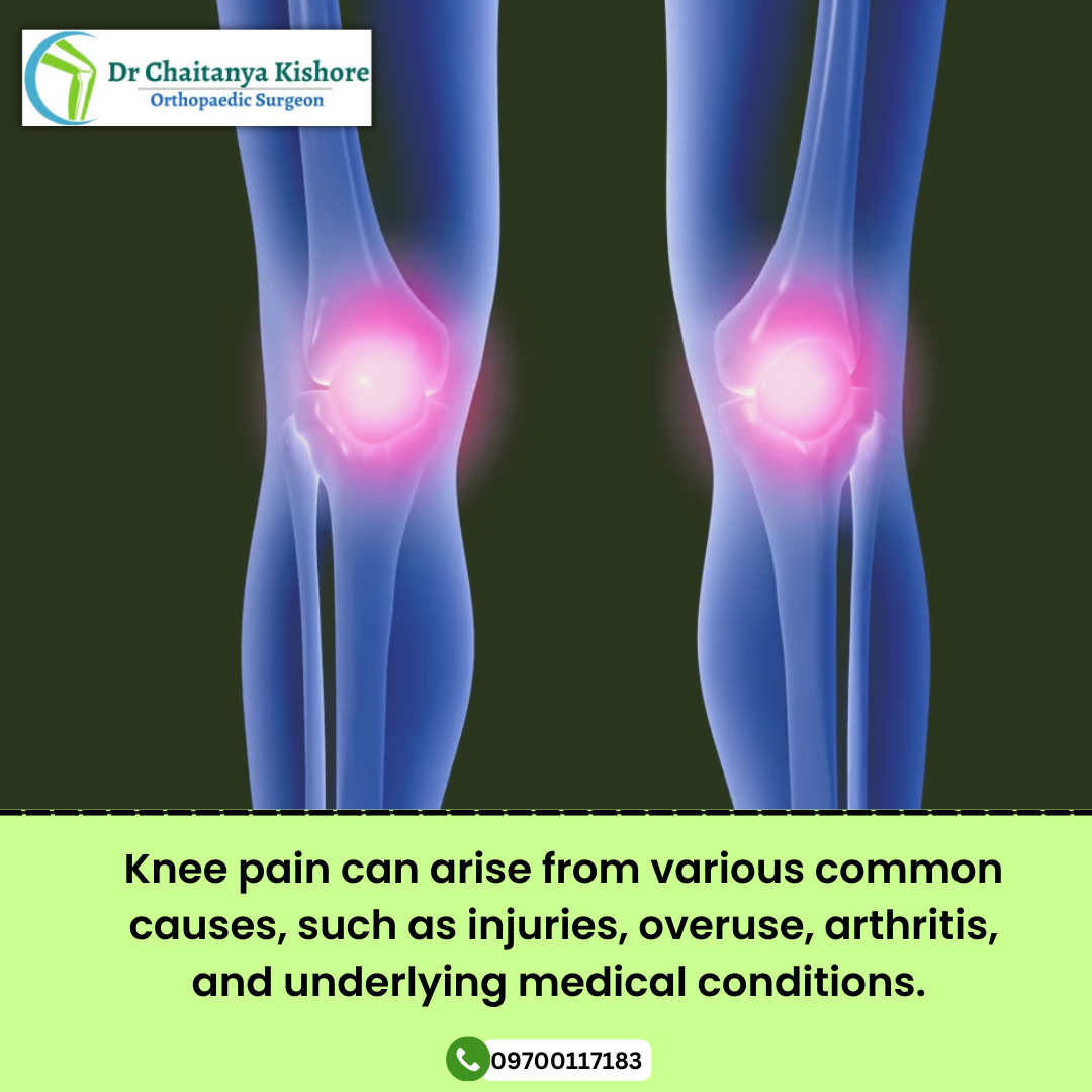 Knee Pain - Drchaitanyakishore - Medium Knee Pain - Drchaitanyakishore - Medium