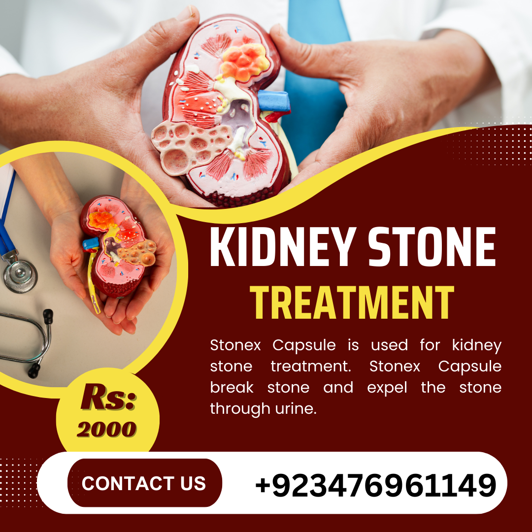 Kidney & Urinary track stone treatment +923476961149 |No Surgery| | by ...