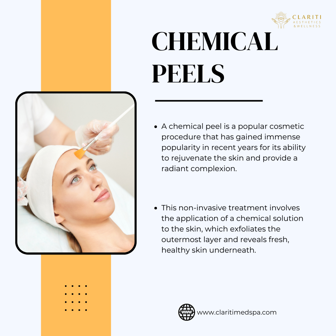 Chemical Peel in Houston, TX: Your Ultimate Guide to Glowing Complexion ...