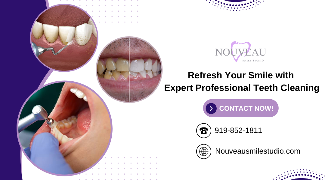 Keep Your Smile Bright with Professional Teeth Cleaning - Nouveau Smile ...