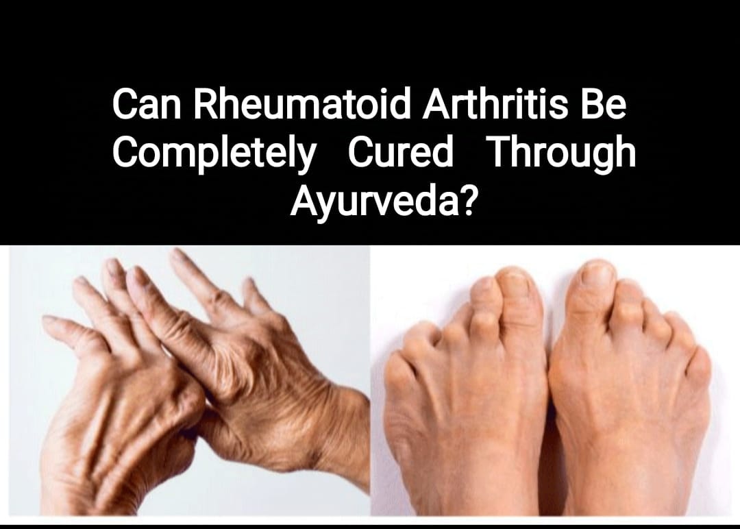 Understanding Ama Vata (Rheumatoid Arthritis) in Ayurveda | by PMADI ...