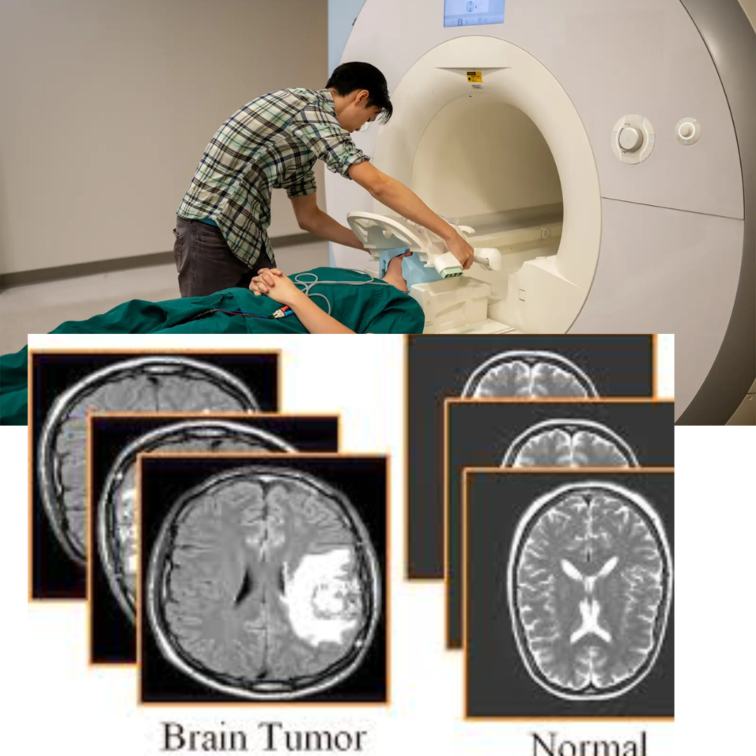 Experience Cutting-Edge Brain MRI at Sanjivini Diagnostics, Chandigarh ...