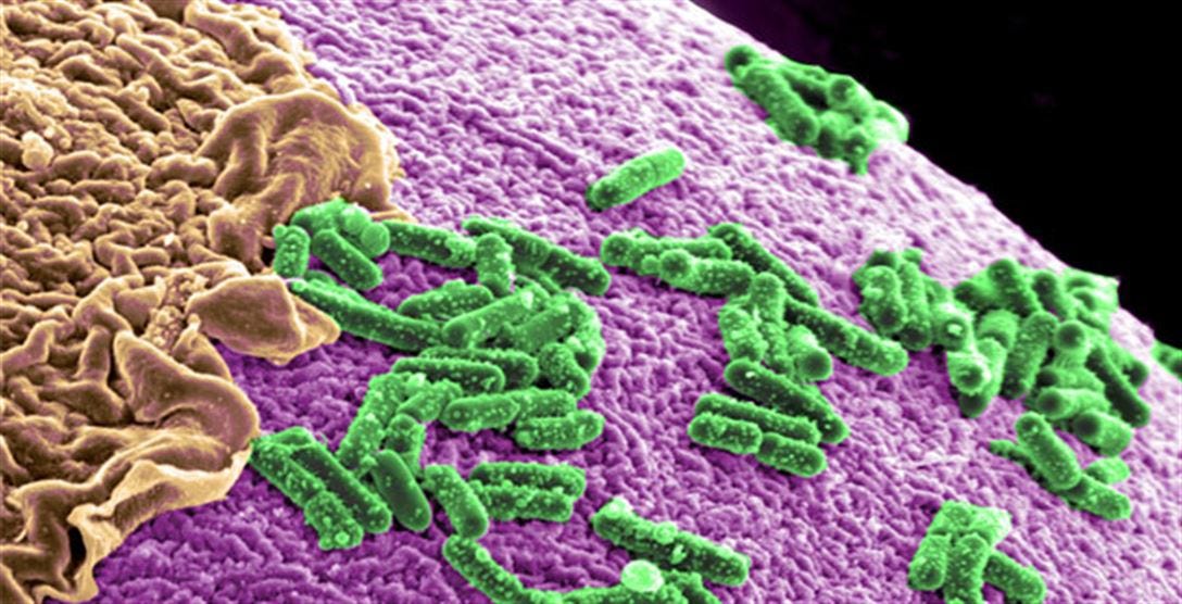 Microbes 101: An Introduction. You probably don’t care much for… | by ...