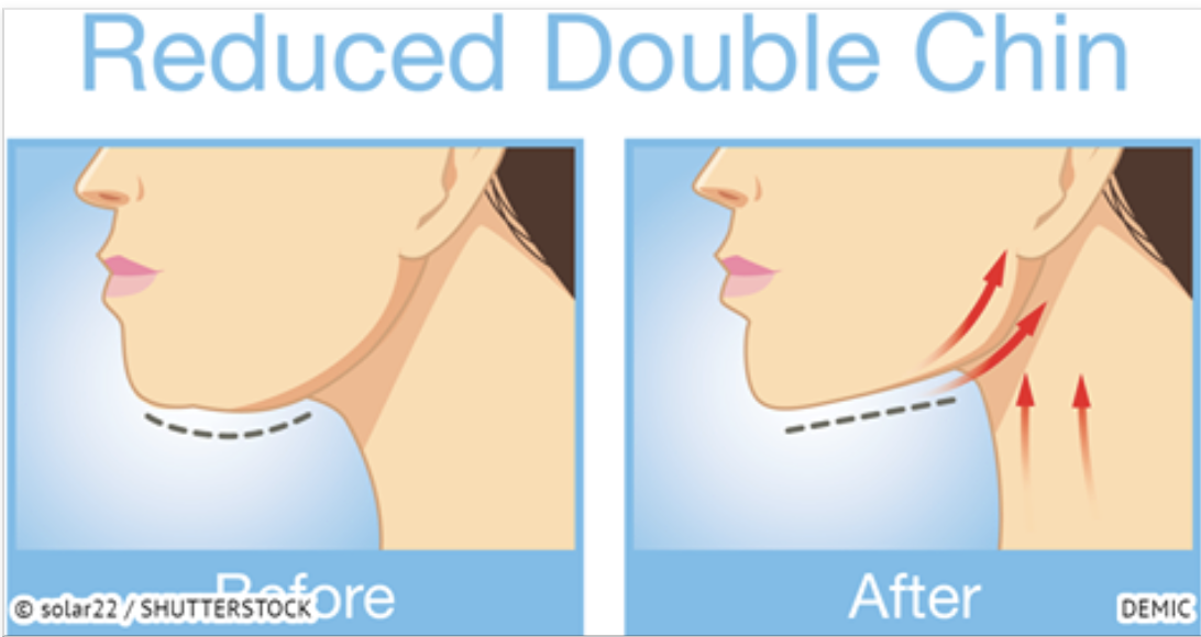 How to Lose Weight in Your Neck — What You Need to Know | by Easy Fat ...