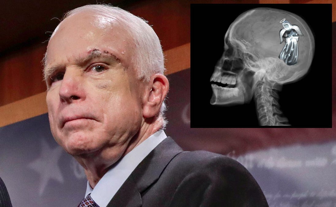 Brain Surgeons Face Lawsuit After Accidentally Leaving Conscience ...