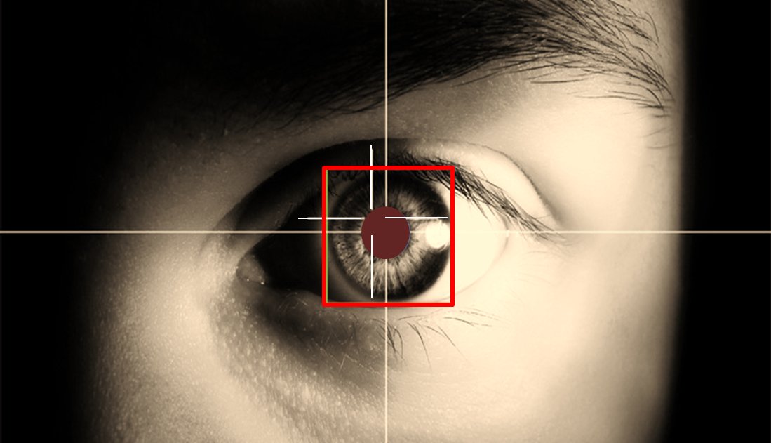 Select India hospital for squint surgery India. | by WeCareIndia | Medium