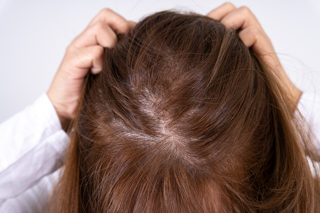 11 Potential Causes of Hair Loss and Baldness | by Blert | Jul, 2023 ...