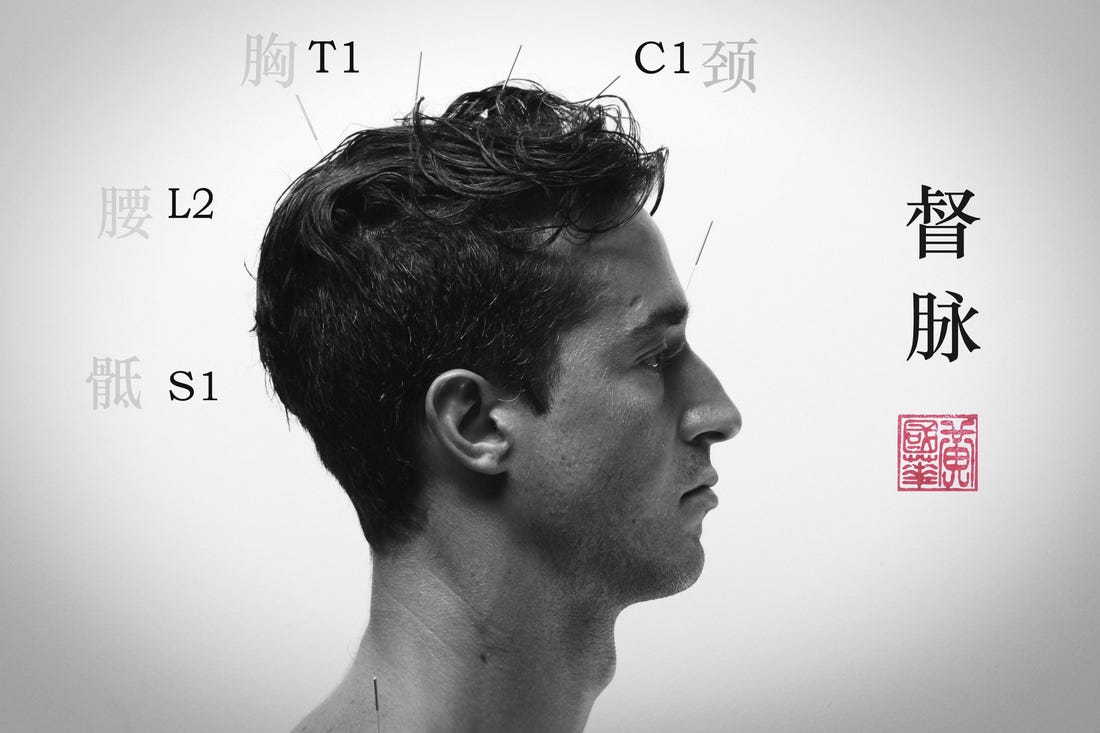 Using the Scalp as Image of the Spine | by Art of Acupuncture | Medium
