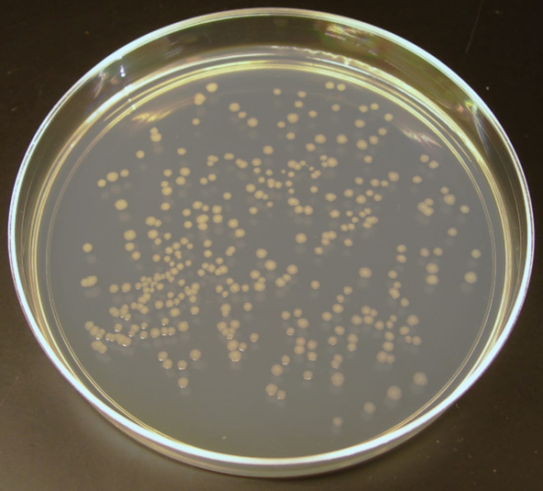 #Bacteria, #Incubation, #IsolationOfMicroorganism, # ...