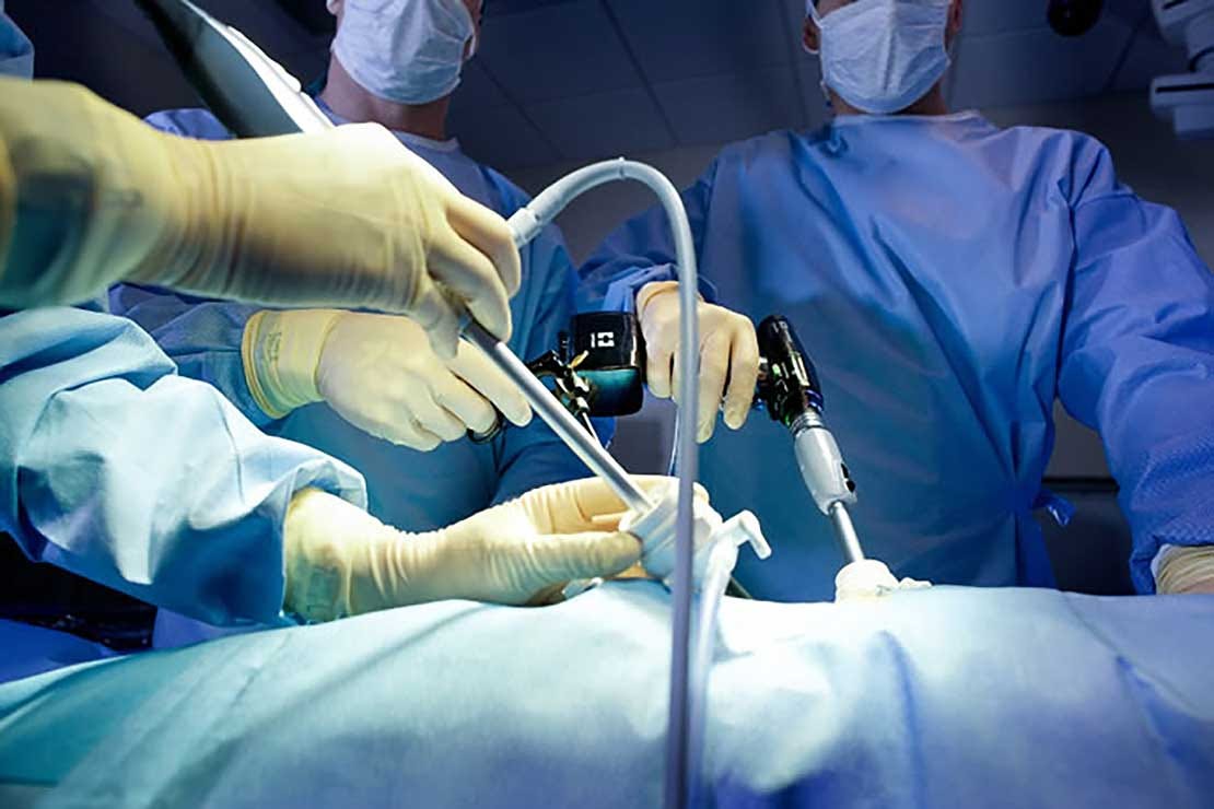 Life After Bariatric Surgery- All Information You Need | by Dr Anirudh ...
