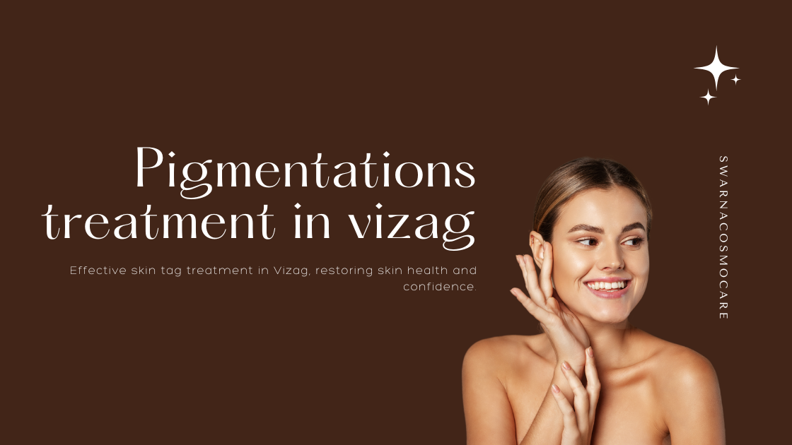 Unveil Flawless Skin: Leading Pigmentation Treatment in Vizag at Swarna ...