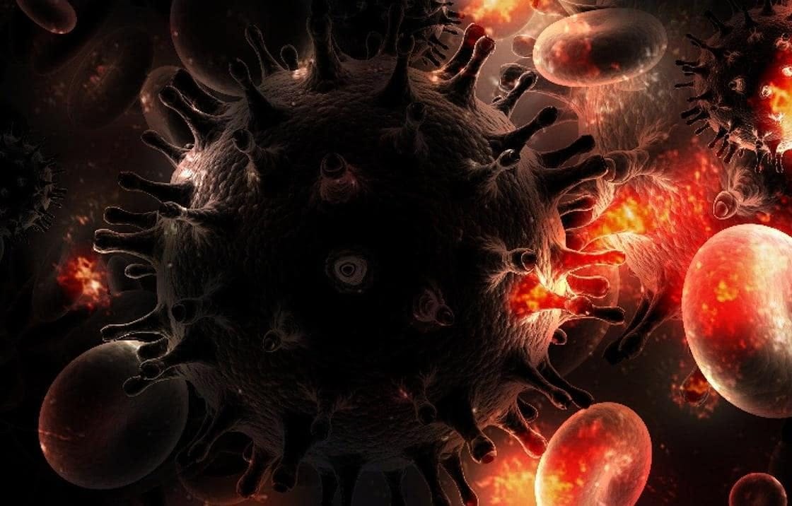 How AIDS affect human body and AIDS definition, symptoms & cure | by ...