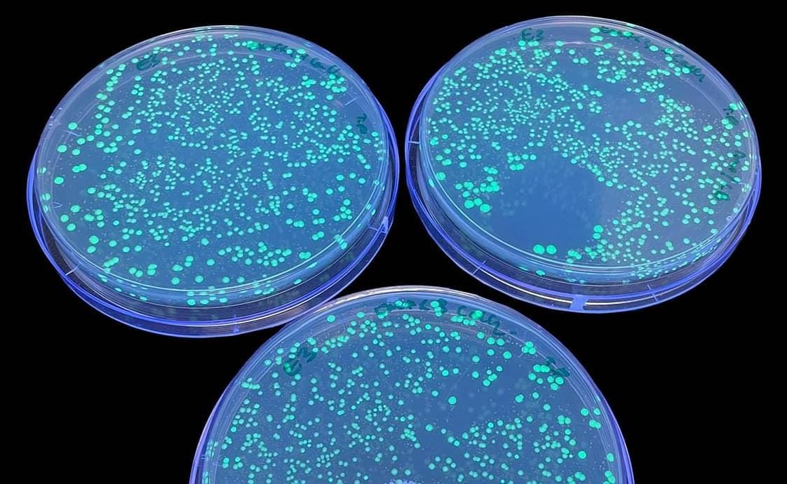 Automated Bacterial Colony Counters Provide Accurate Analysis and ...