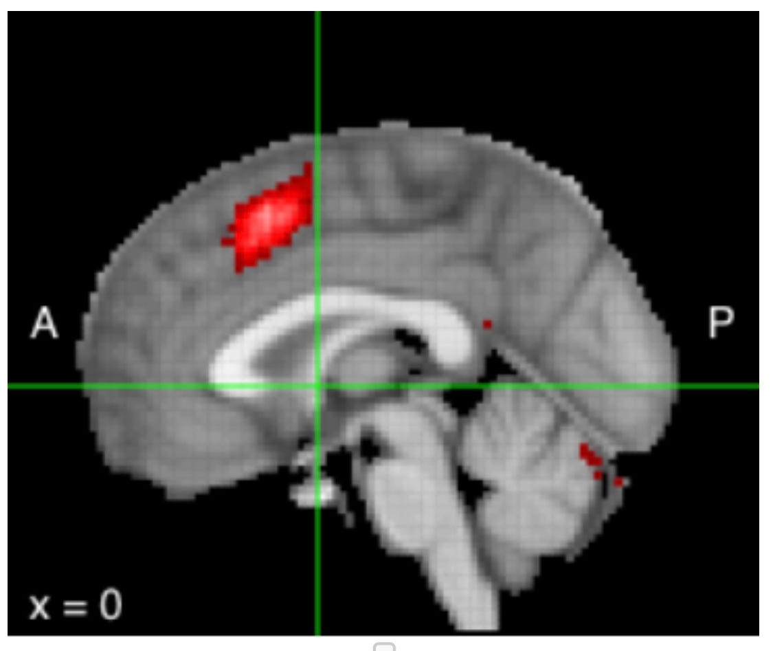 The Brain Science Behind Sharing and its Impact on Social Media | by ...