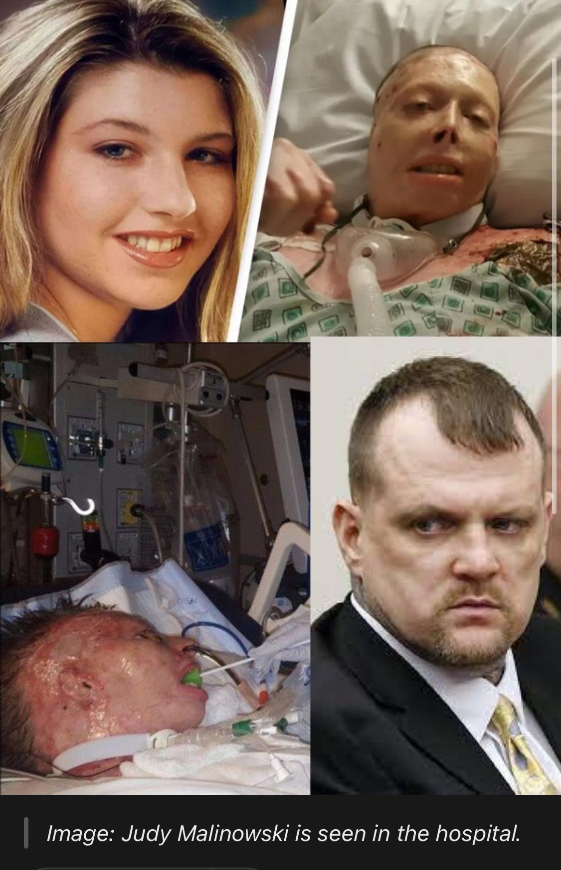 Judy Malinowski was a cancer survivor who became addicted to ...