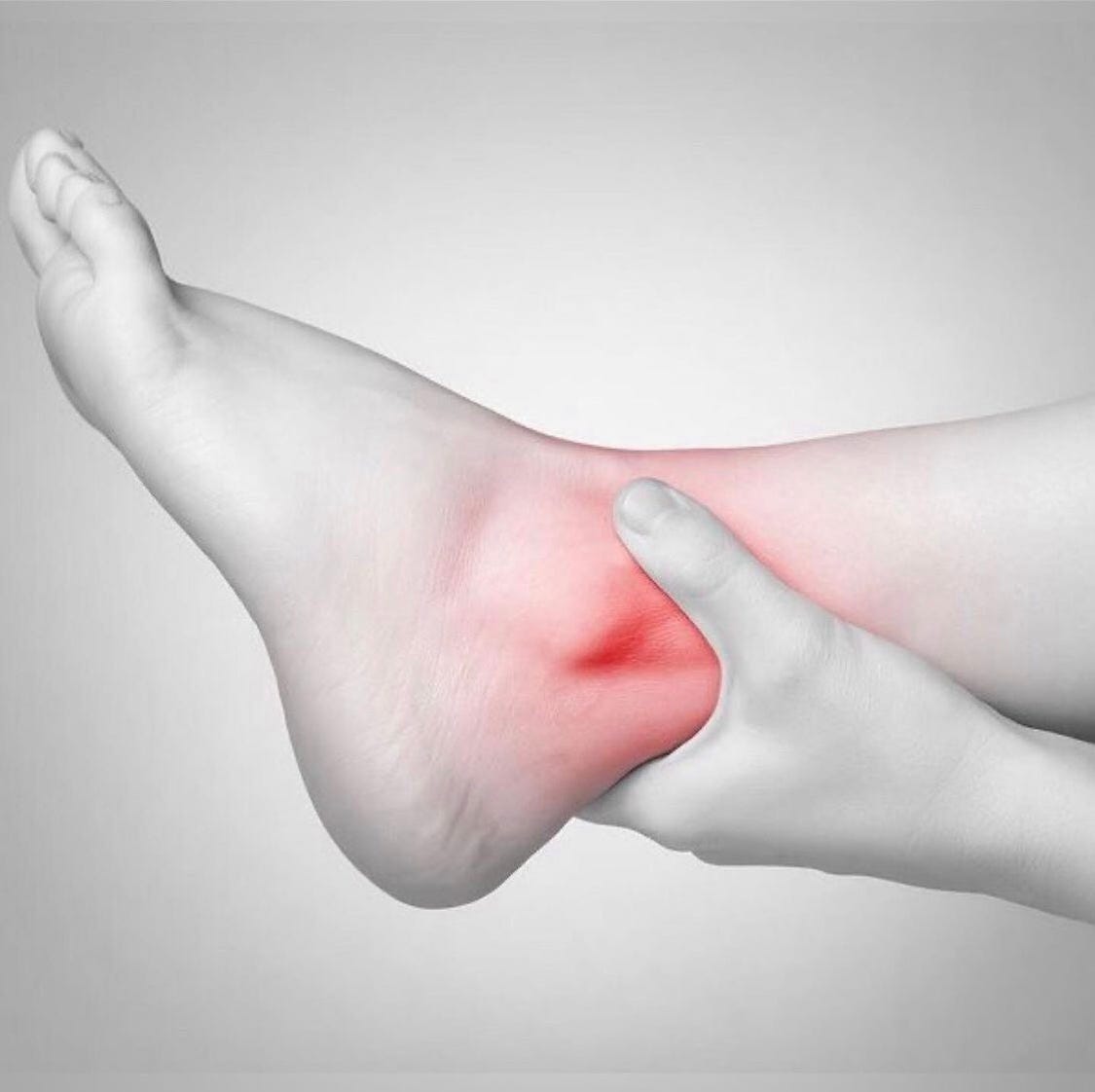 𝐒𝐩𝐫𝐚𝐢𝐧 Vs 𝐒𝐭𝐫𝐚𝐢𝐧. Sprains and strains are among the most… | by Biwêgnon ...