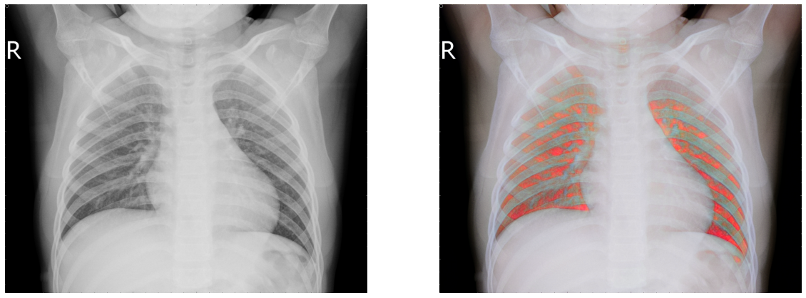 X-Ray Colorization and Neural Networks | by Erica Gabriel | Medium