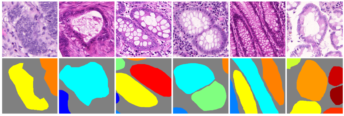 Review: MultiChannel — Segment Colon Histology Images (Biomedical Image ...