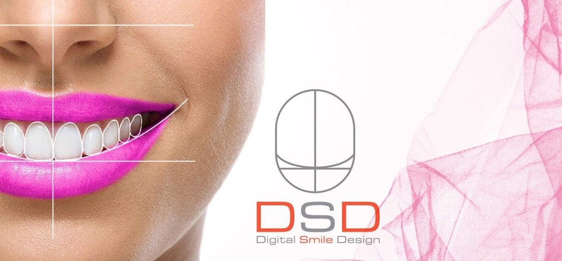 Smile Makeover in Gurgaon | Digital Smile Designing Gurgaon | by 32 ...