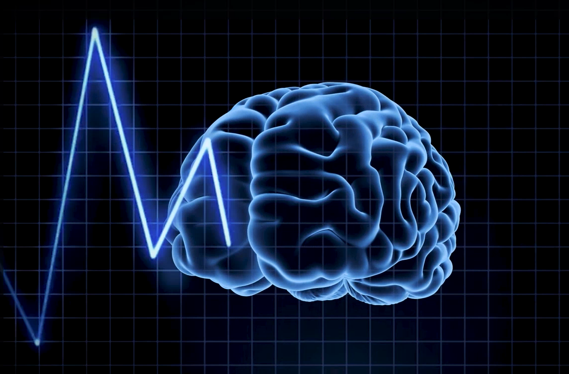 Using Resting State EEG Data of Patients with Epilepsy For Functional ...