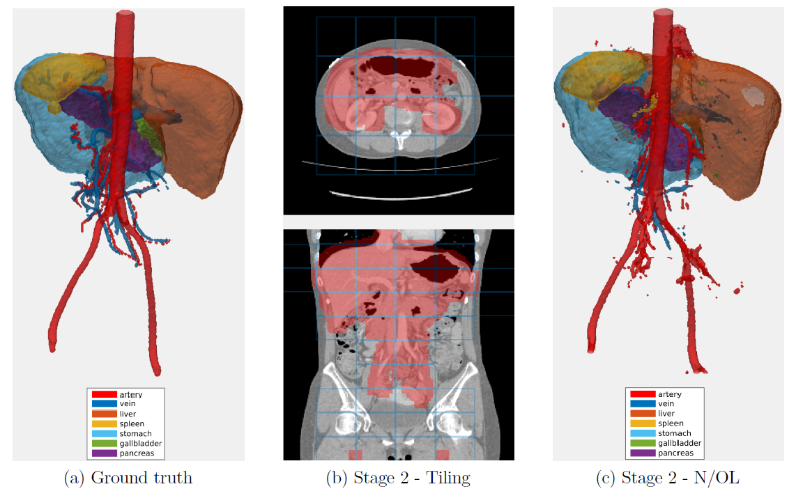 Review: Cascaded 3D U-Net — Multi-Organ Segmentation (Biomedical Image ...