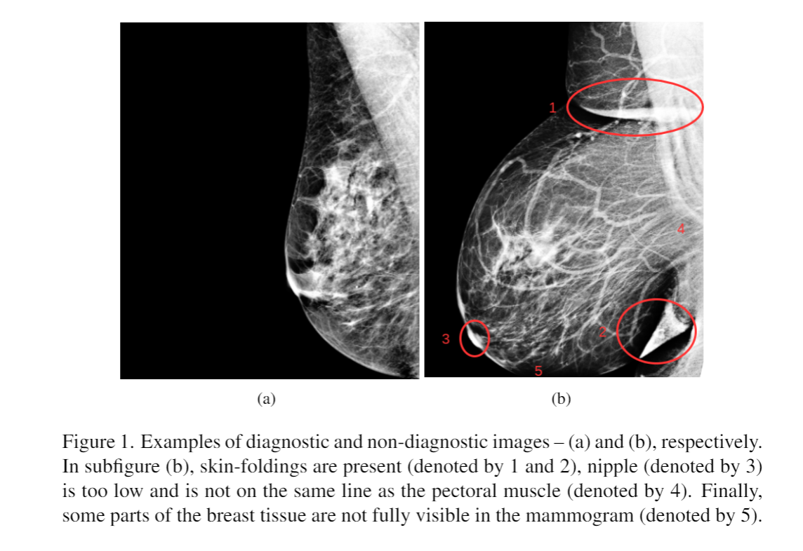 Automatic Quality Assessment In Mammography Screening A Deep Learning