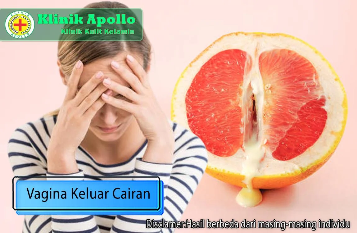Penyebab Vagina Keluar Cairan Aneh dan Bau | by Klinik Apollo | Feb ...
