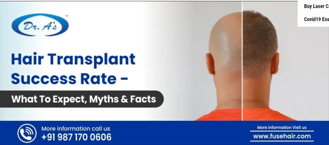 Hair Transplant Success Rate — What To Expect Myth and Facts ...
