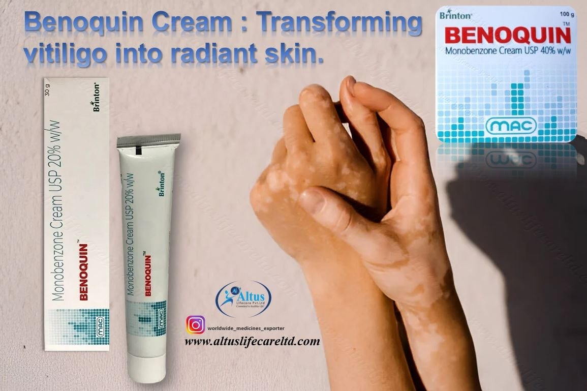 Benoquin Cream 20%: The Breakthrough Solution for Vitiligo You Need ...
