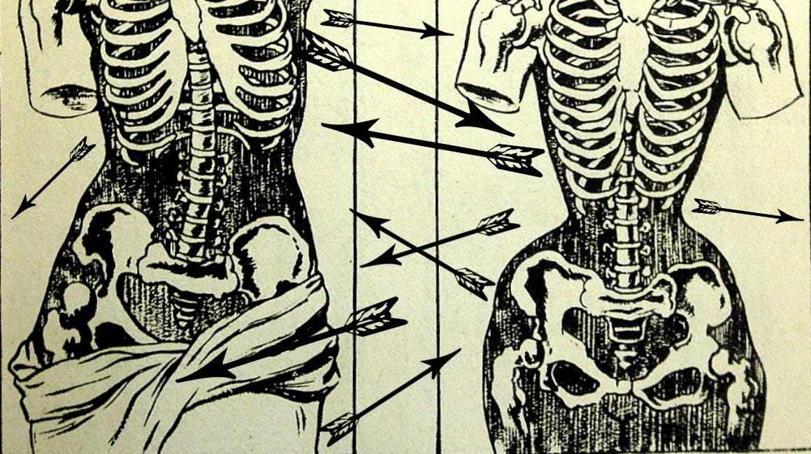 The Civil War Raging Inside My Body | by The Establishment | Intimates ...